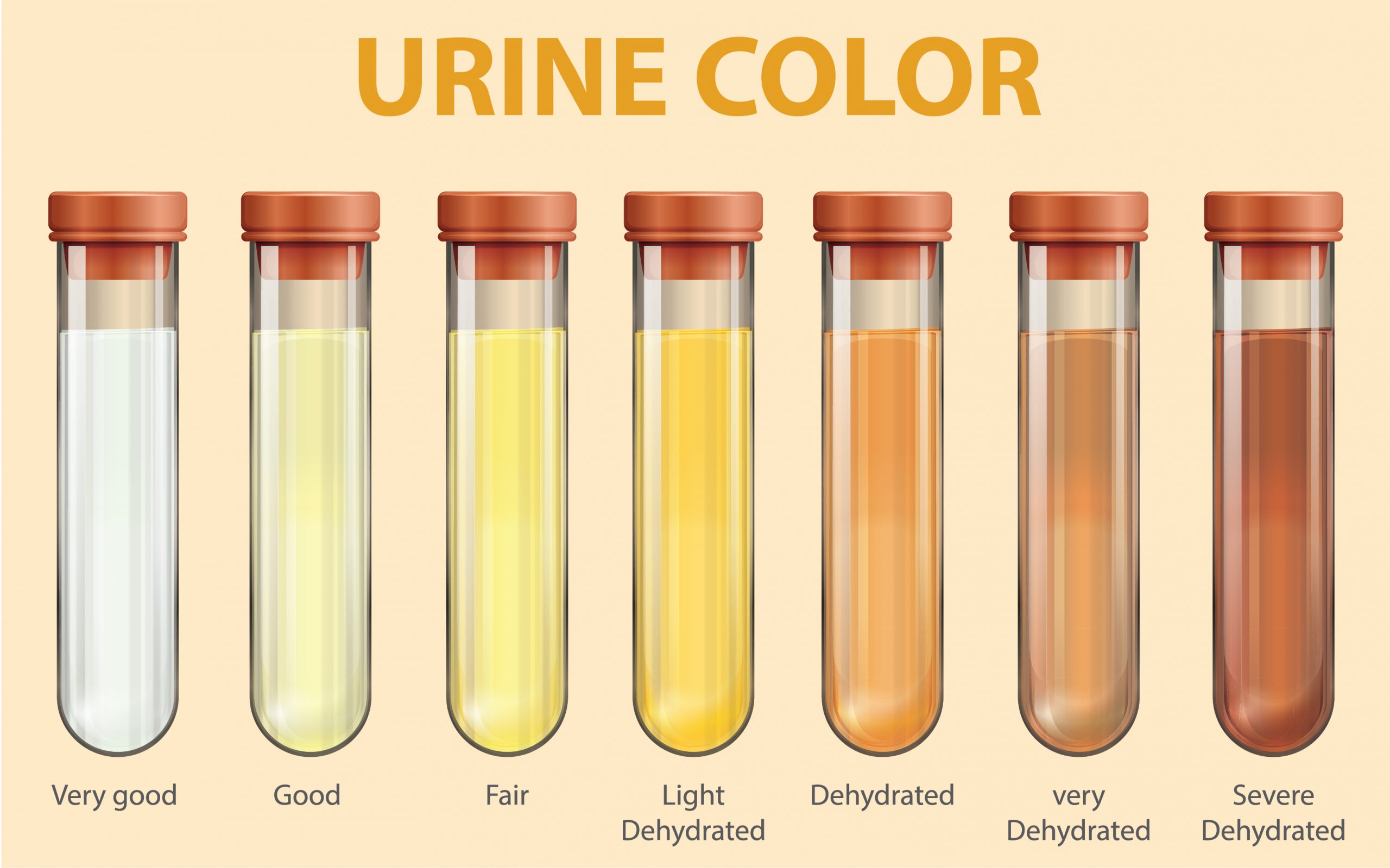 The color of urine gives a sign of disease, know whether you are also a ...